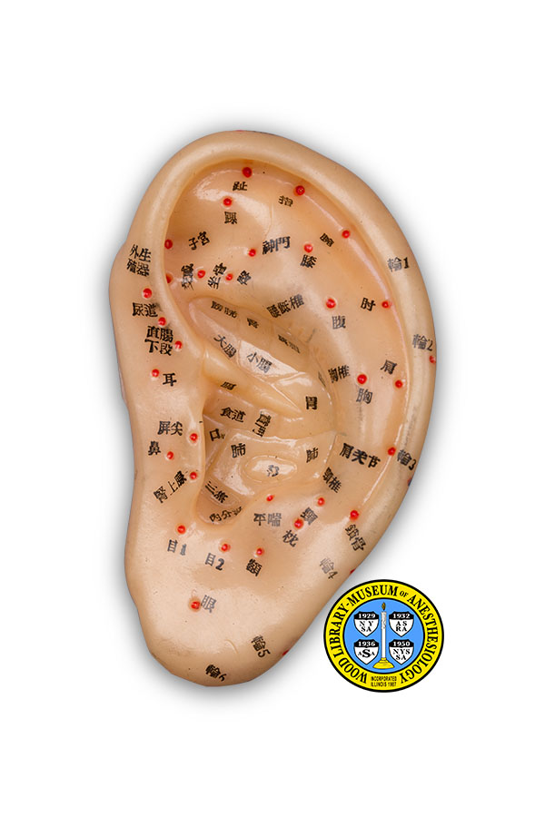 Acupuncture Ear Model - Wood Library-Museum of Anesthesiology